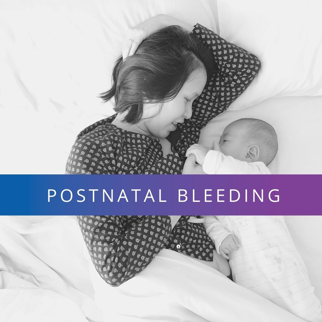 Postnatal Bleeding Women s Obstetrics Gynaecology Specialists postnatal-bleeding-women-s-obstetrics-gynaecology-specialists